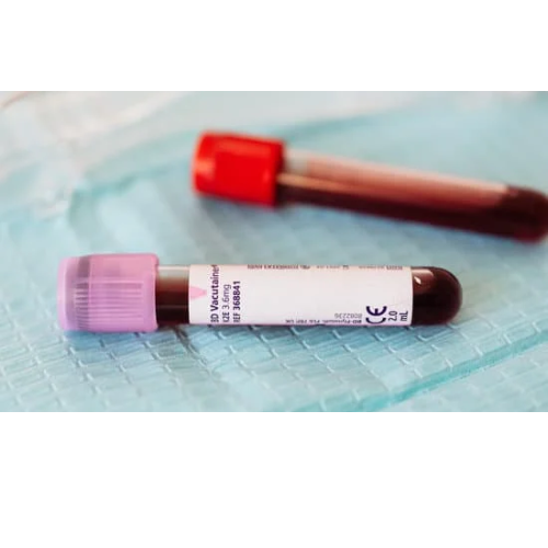 Adult Venipuncture – EKI Lab Services